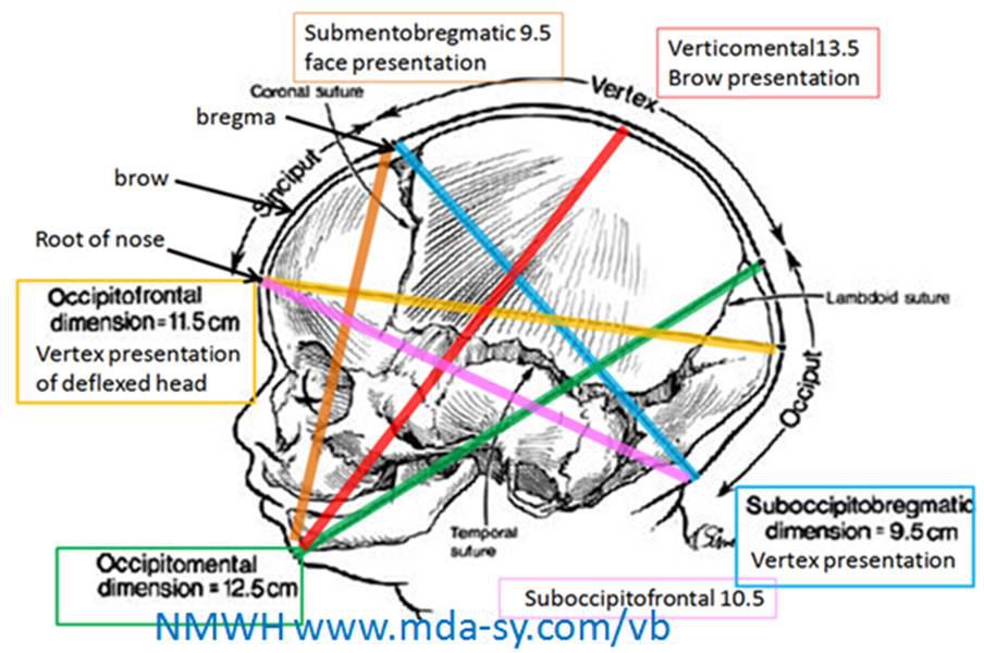 STUDY WITH FUN Diameters Of Fetal Skull study-with-fun-diameters-of-fetal-skull