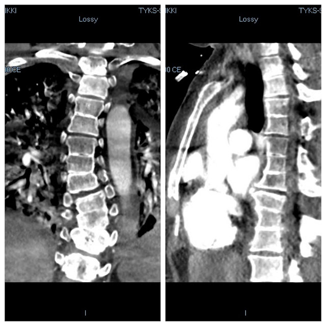 Tules tuo: Katsellaan kuvia