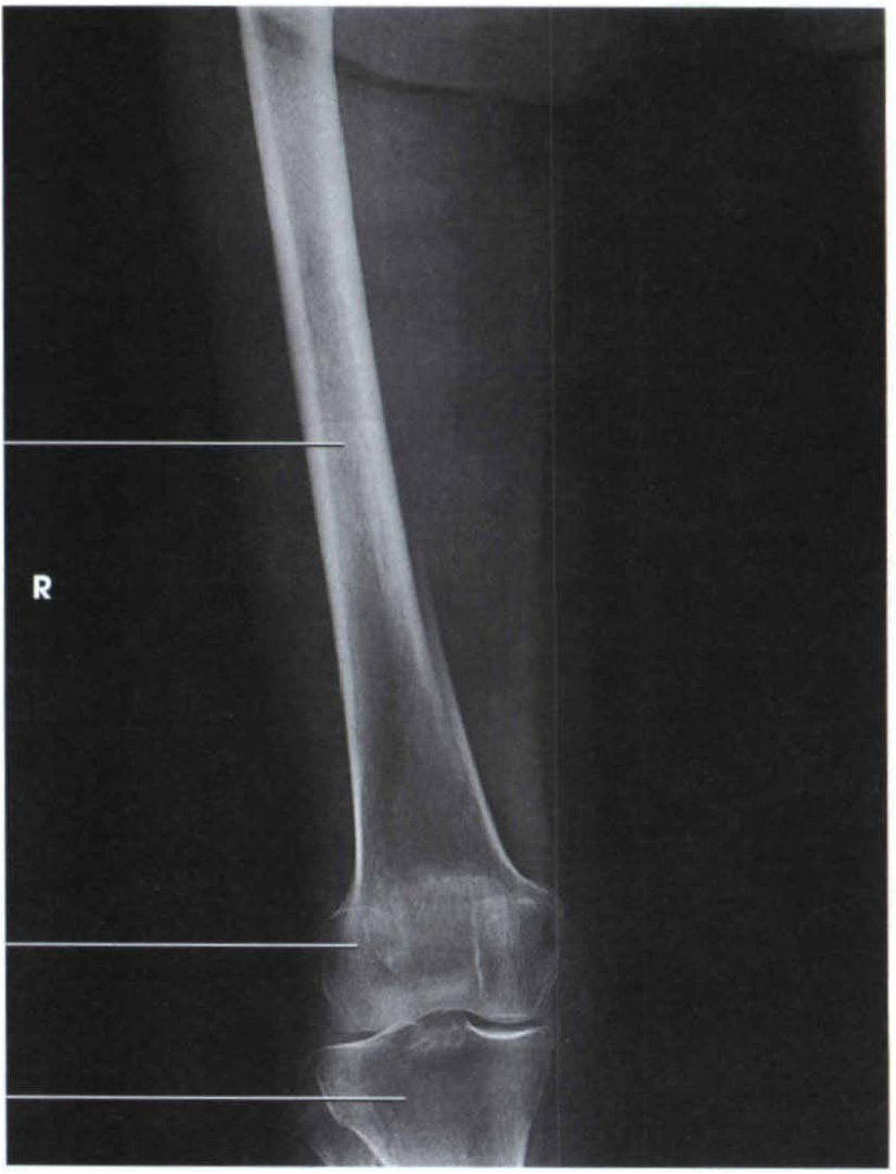 Gudang Medis: teknik radiografi femur