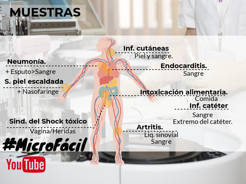 Staphylococcus aureus