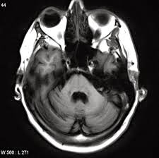 Medical Treatment Pictures-for Better Understanding: Multiple System ...