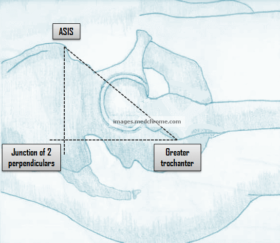 RealMadrid: KỸ NĂNG LÂM SÀNG NGOẠI: KHÁM CÁC MỐC GIẢI PHẪU VÀ ĐO CHIỀU ...
