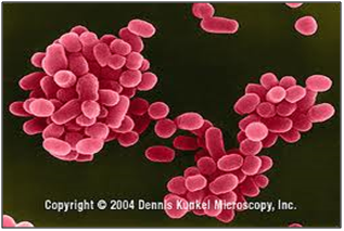 MICROBIOOLOGIA Y PARACITOLOGIA : Diferentes enfermedades producidas por ...