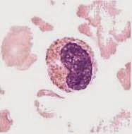 FICHERO DE HEMATOLOGIA: GLÓBULOS BLANCOS