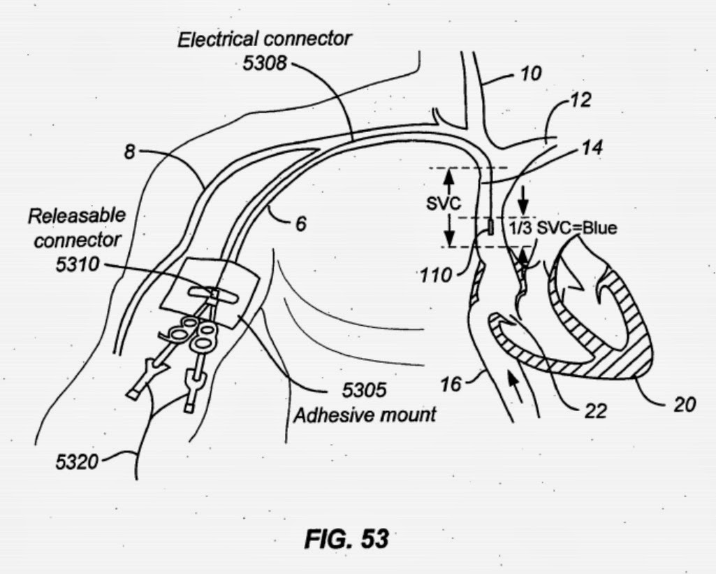 PTAB.US: flo healthcare
