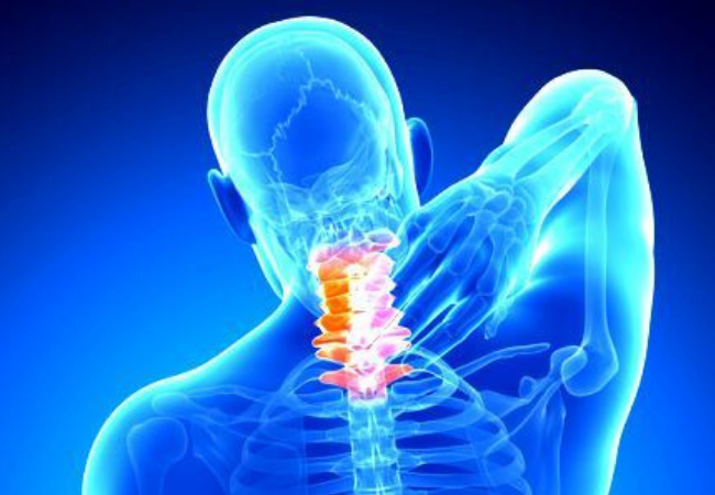 Leher Kaku Berhari-Hari, Jangan Disepelekan! Bisa Jadi Tanda Penyakit Ini