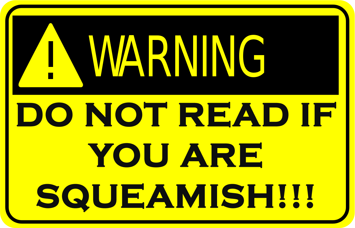 Kat Runs A Half!: Gross Anatomy (Long Post, Lots of Pics)