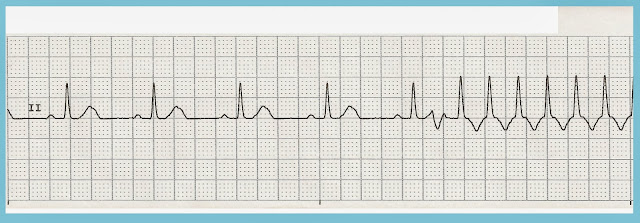 Practice EKG Rhythm Strips 234