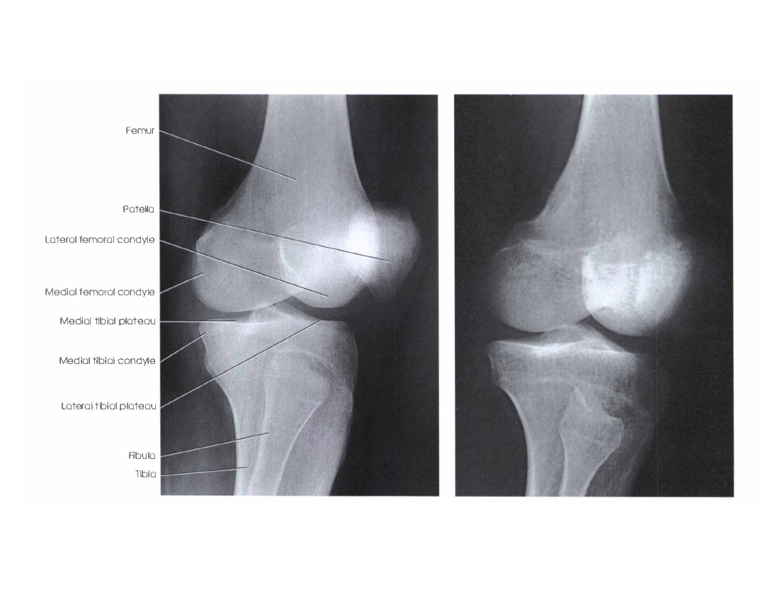TEKNIK PEMERIKSAAN KNEE JOINT