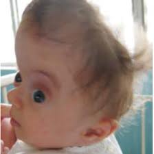 Semiologia Quirurgica: EXAMEN DE LA CABEZA, DEL CUELLO, DE LOS OJOS Y ...