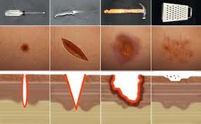 Forensic Management (Criminalistica, Ciencias Forenses y Jurídicas ...