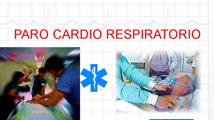 Paro Cardio Respiratorio | USMP FN Archivos
