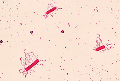 Medical Laboratory and Biomedical Science: Bacillus cereus - Leifson ...