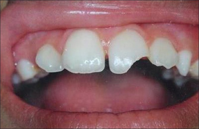 Dentistry and Medicine: Dental Trauma-Paediatric Emmergency Department ...