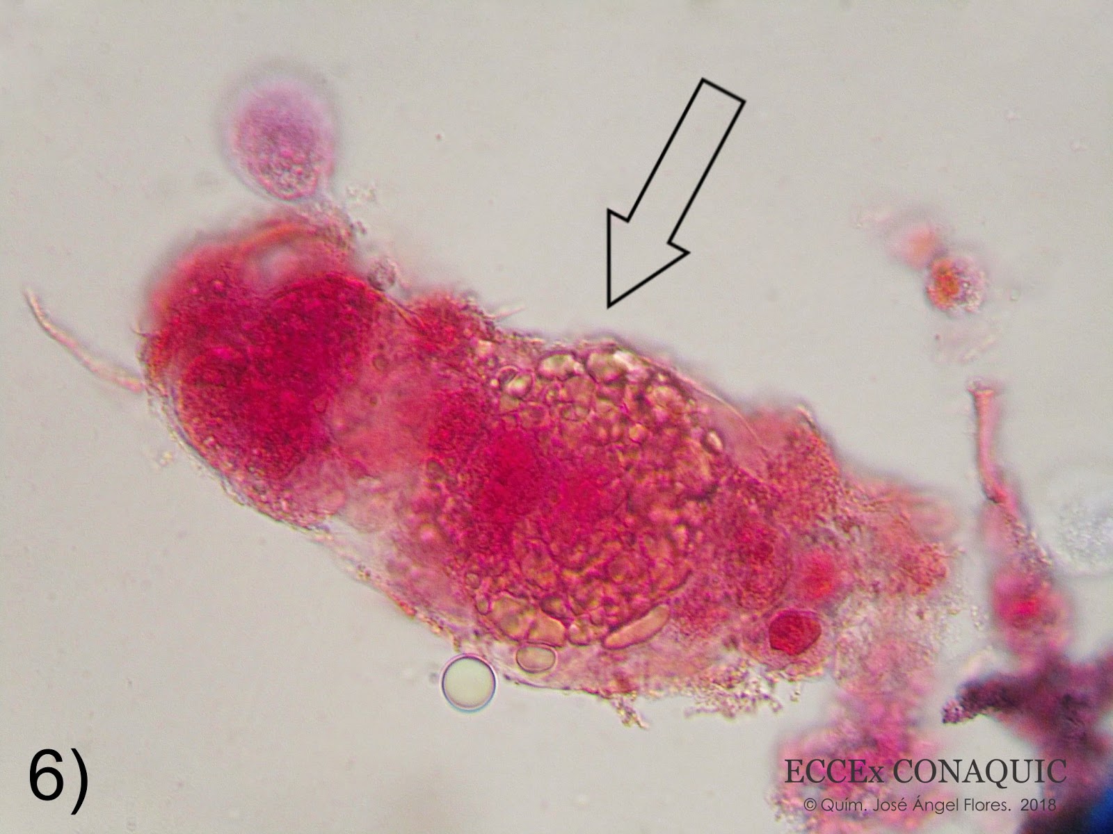 Examen General de Orina: 2018