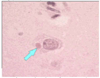 Virus dại: Rabies virus - Sinh Học Phân Tử