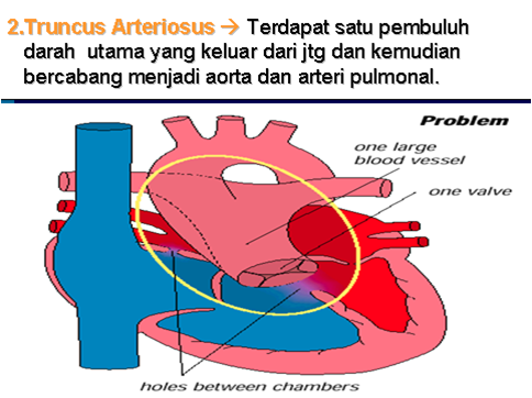 SISTEM KARDIOVASKULER 1 & 2 : Congenital Heart Disease (CHD)