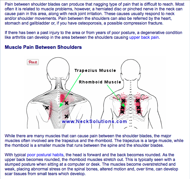 Shoulder / ПЛЕЧИ: Pain Between Shoulder Blades