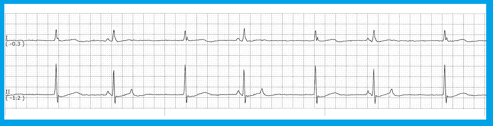 Various Escape Beats