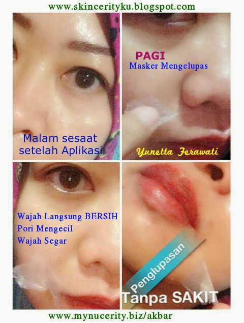 Skincerity | BB 28A3C1CF | HP 0813-5847-9504 | Nightly Breathable ...