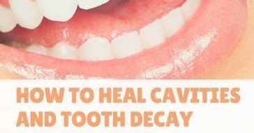 How to Heal Cavities and Tooth Decay Naturally with These Home Remedies ...