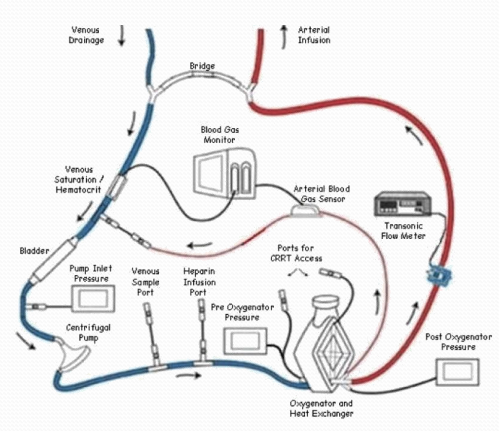 ER goldbook: ECMO (1/6): indication, equipment
