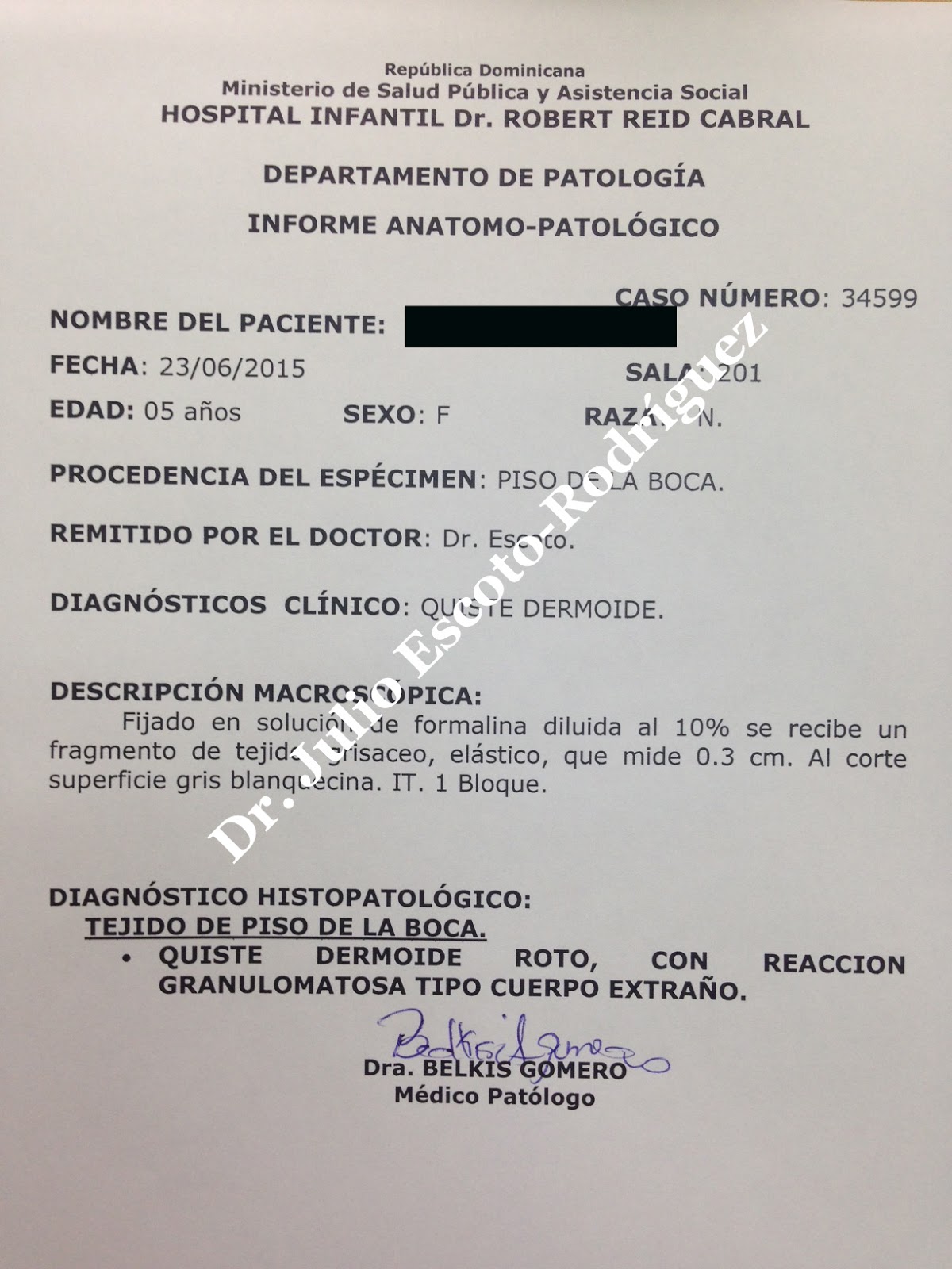 Casos de Cirugía Bucal y Maxilofacial : Caso No. 56: Quiste Dermoide ...