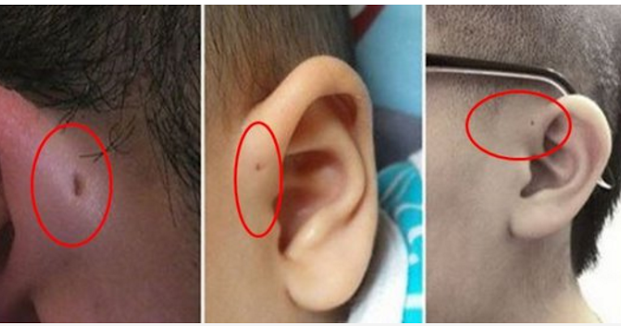 Oh ternyata Inilah Artinya Lubang Diatas Telinga, Mengejutkan!! - Kisah ...