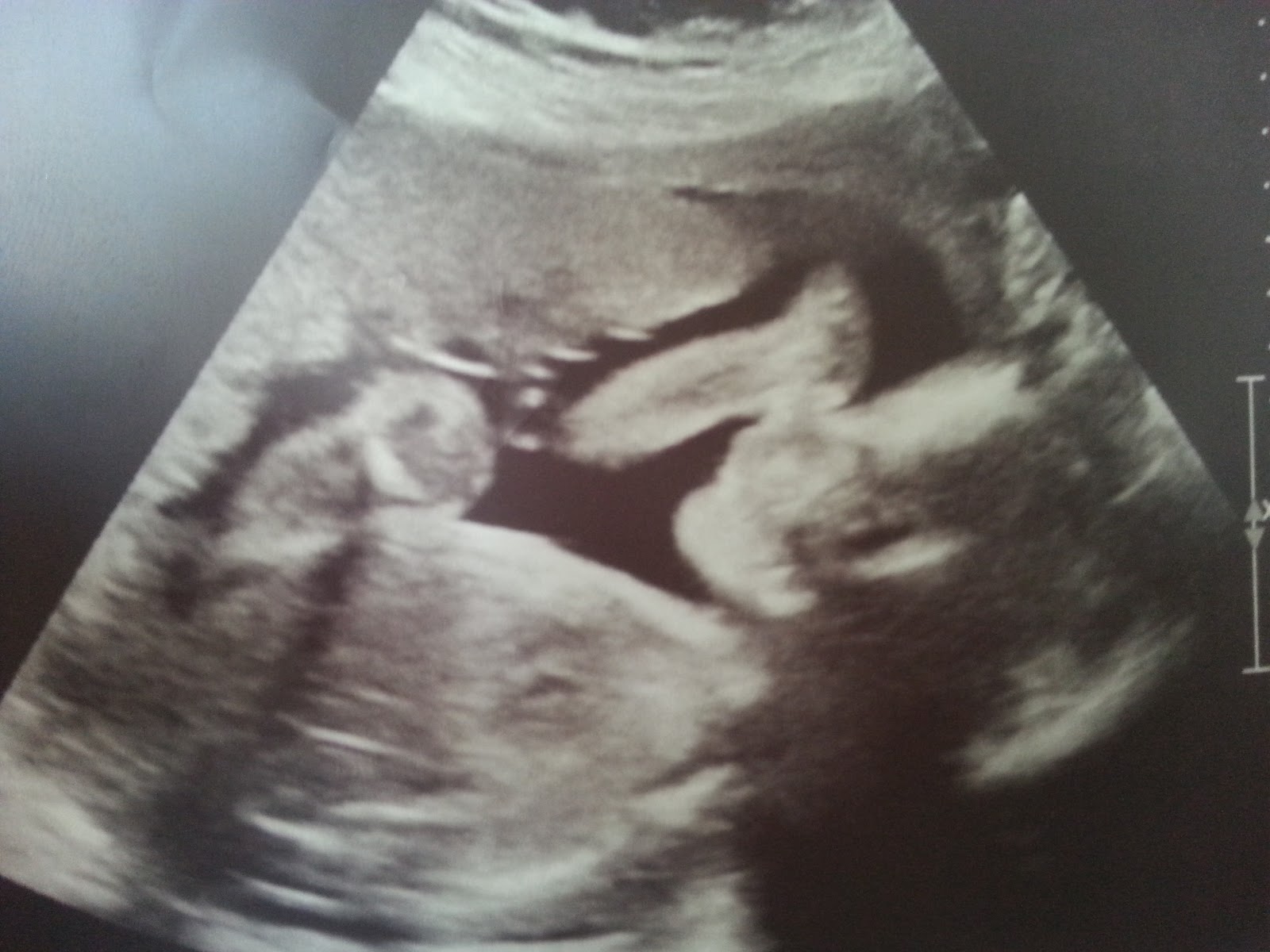 One day at a Time: Pregnancy. 27 weeks and 5 days