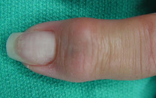 TRAUMATOLOGÍA DE LA MANO