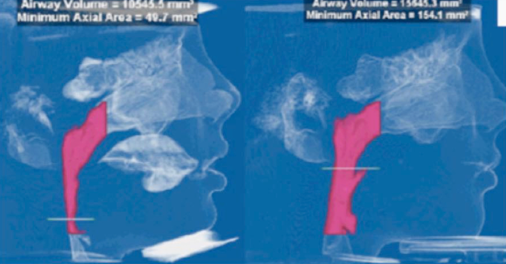 Day 28: The Mighty Tongue - Queen of Dental Hygiene