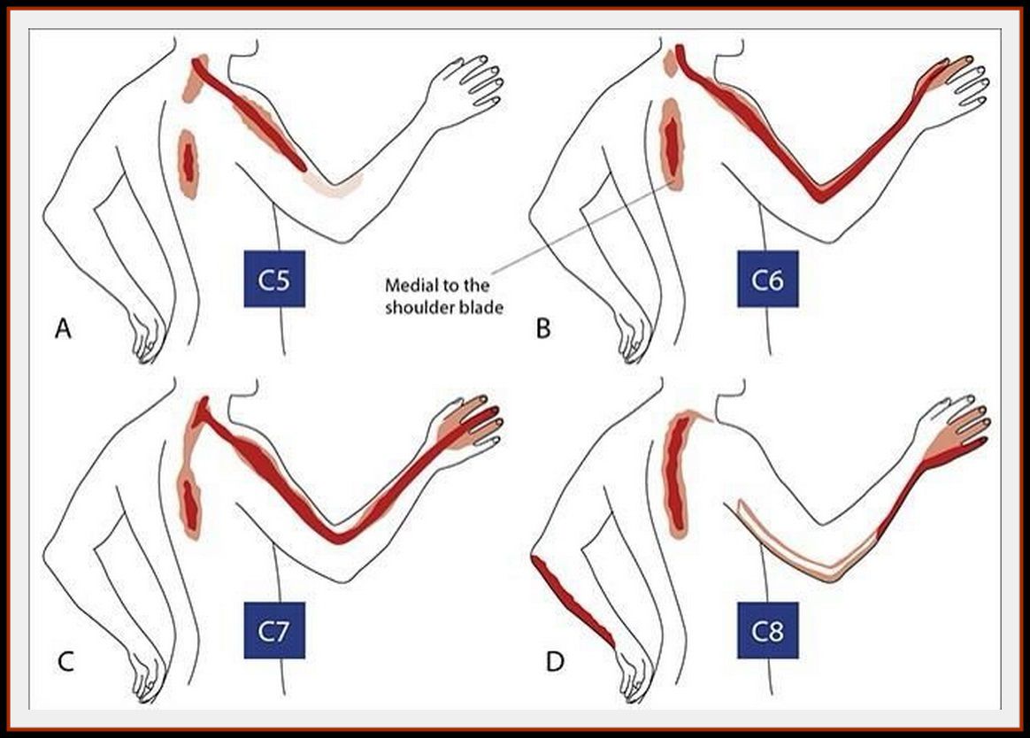 truthlady3: Dermatomes Dermal Segmentation