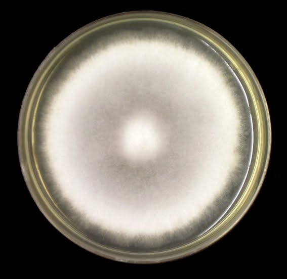 Fun With Microbiology (What's Buggin' You?): Syncephalastrum species