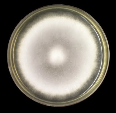 Fun With Microbiology (What's Buggin' You?): Syncephalastrum species