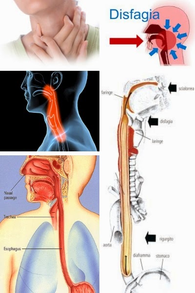 FISIOPATOLOGIA NUTRICIÓN : ESOFAGO