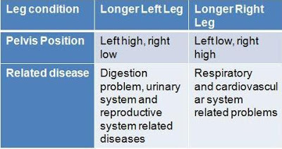 Scoliosis: Do You Have A Longer Left Leg or Right Leg?