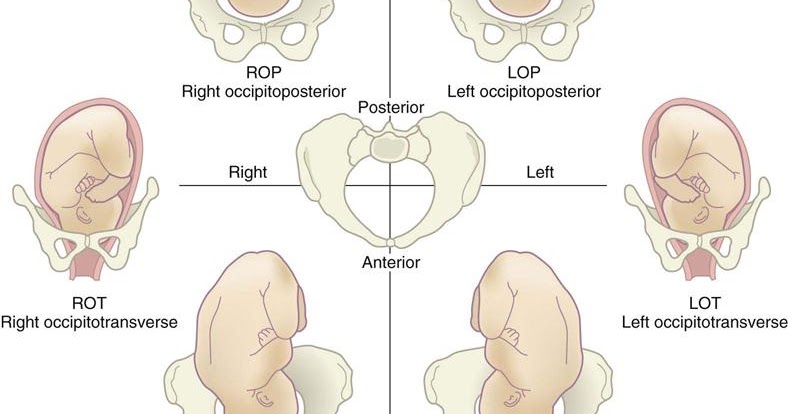 Mechanism of Labour, LOA/ROA | notes.nursium.com