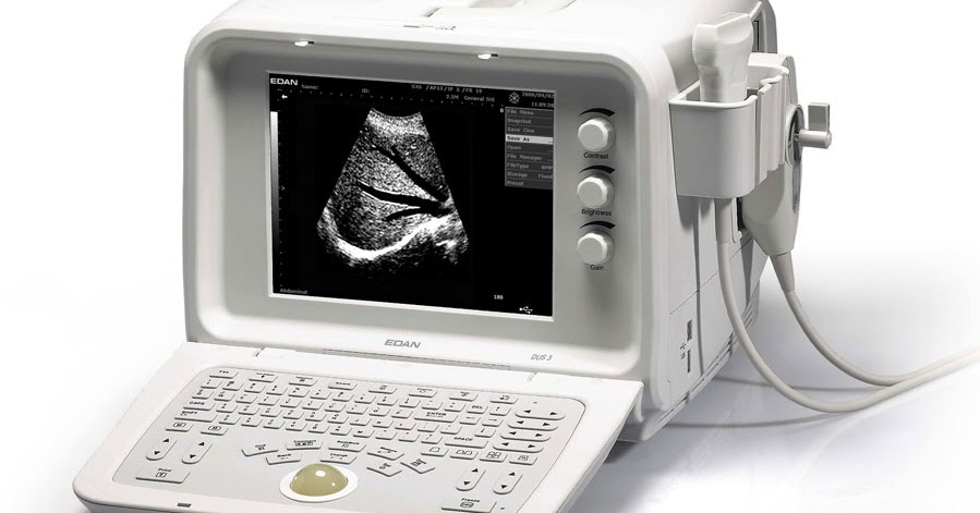 Pemanfaatan Ultrasonography (USG) dalam Kedokteran