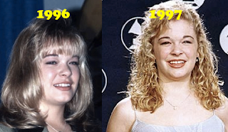 LeAnn Rimes Plastic Surgery