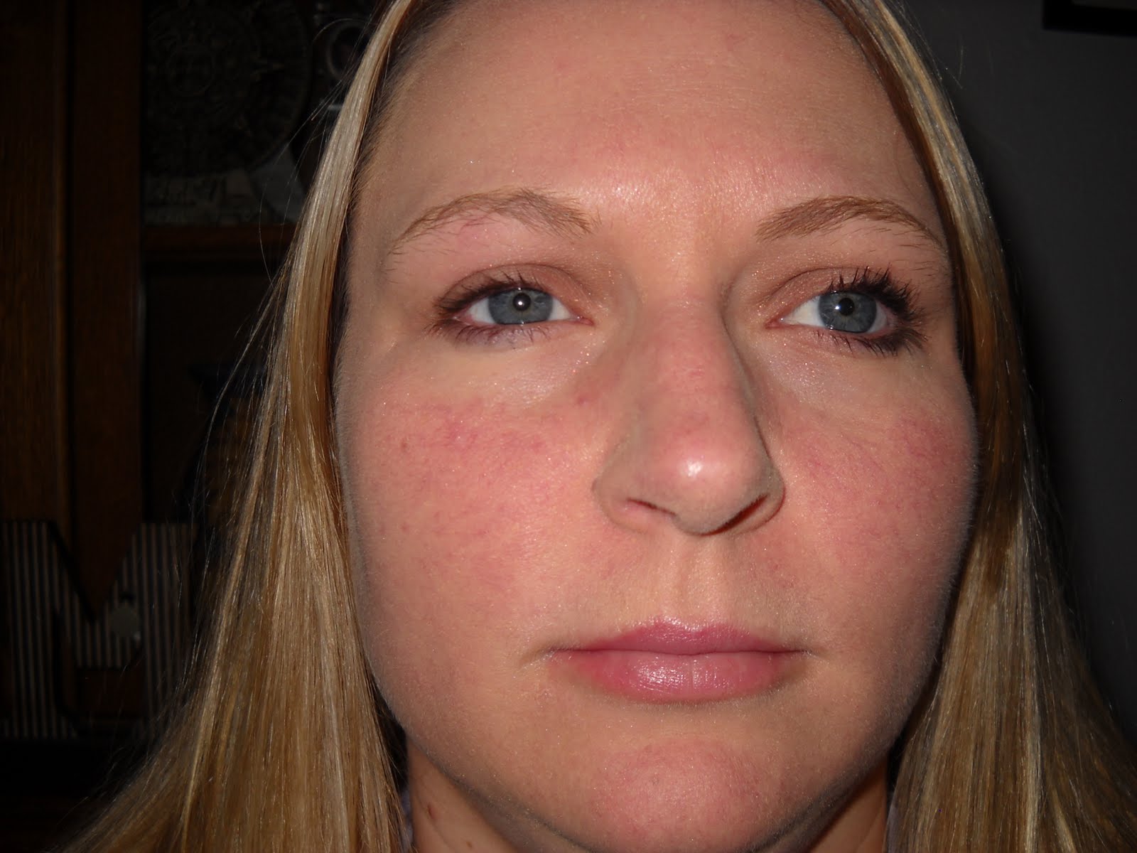 DigginbeingDoziers!: The tale of the crooked eye!