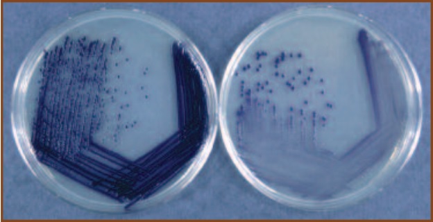 [Microbiology] Atlas of Growth Patterns on Agar | Free Medical Atlas