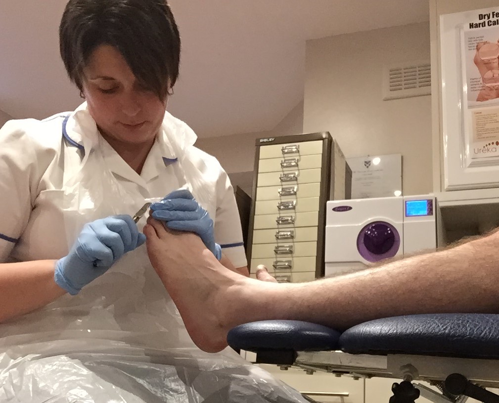 Complete Podiatry Blog: Corns and Callus