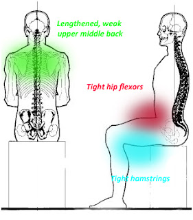 Shortened Hip Flexors