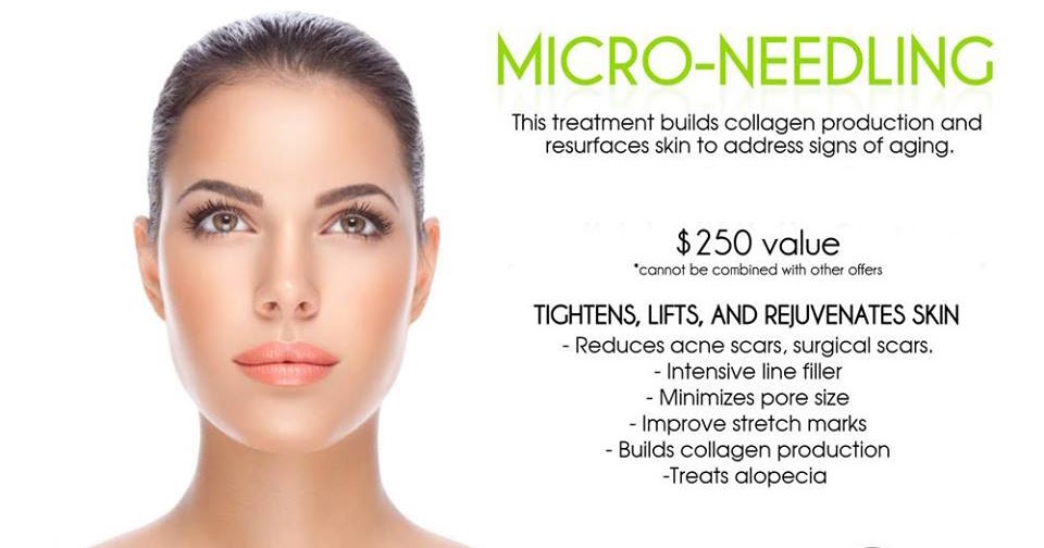 The M Day Spa - Your Beauty Secret: Eliminating Scars and Aging Lines ...