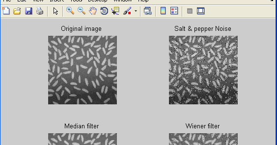 Baba Bouncer: Matlab Code for Image filtering from Salt and Pepper Noise using Median and Wiener ...