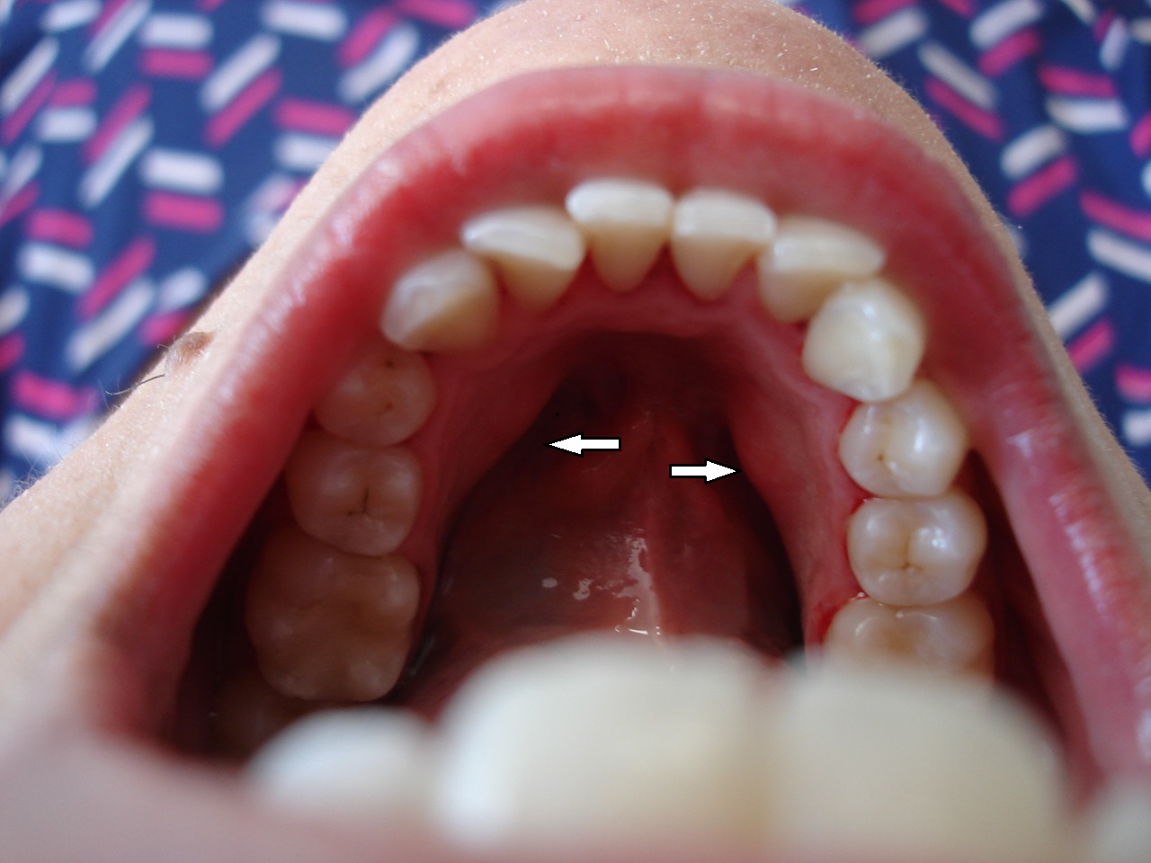 SORRISO! : TÓRUS, o que é isso???