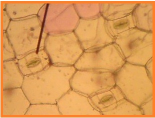 Biologi Gonzaga Osmosis Krenasi Plasmolisis - Riset