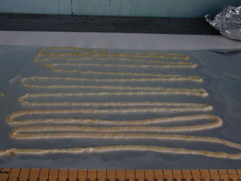 Medical Laboratory Technology - SOP: Taenia Saginata/ Taenia Solium