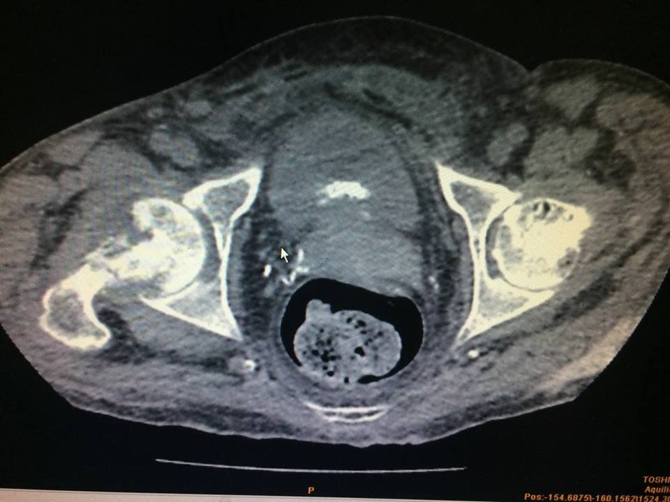 EL RINCÓN DE LA MEDICINA INTERNA. juanpedromacaluso@yahoo.com.ar ...