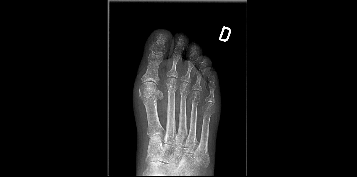 Erasresidente: Imágenes